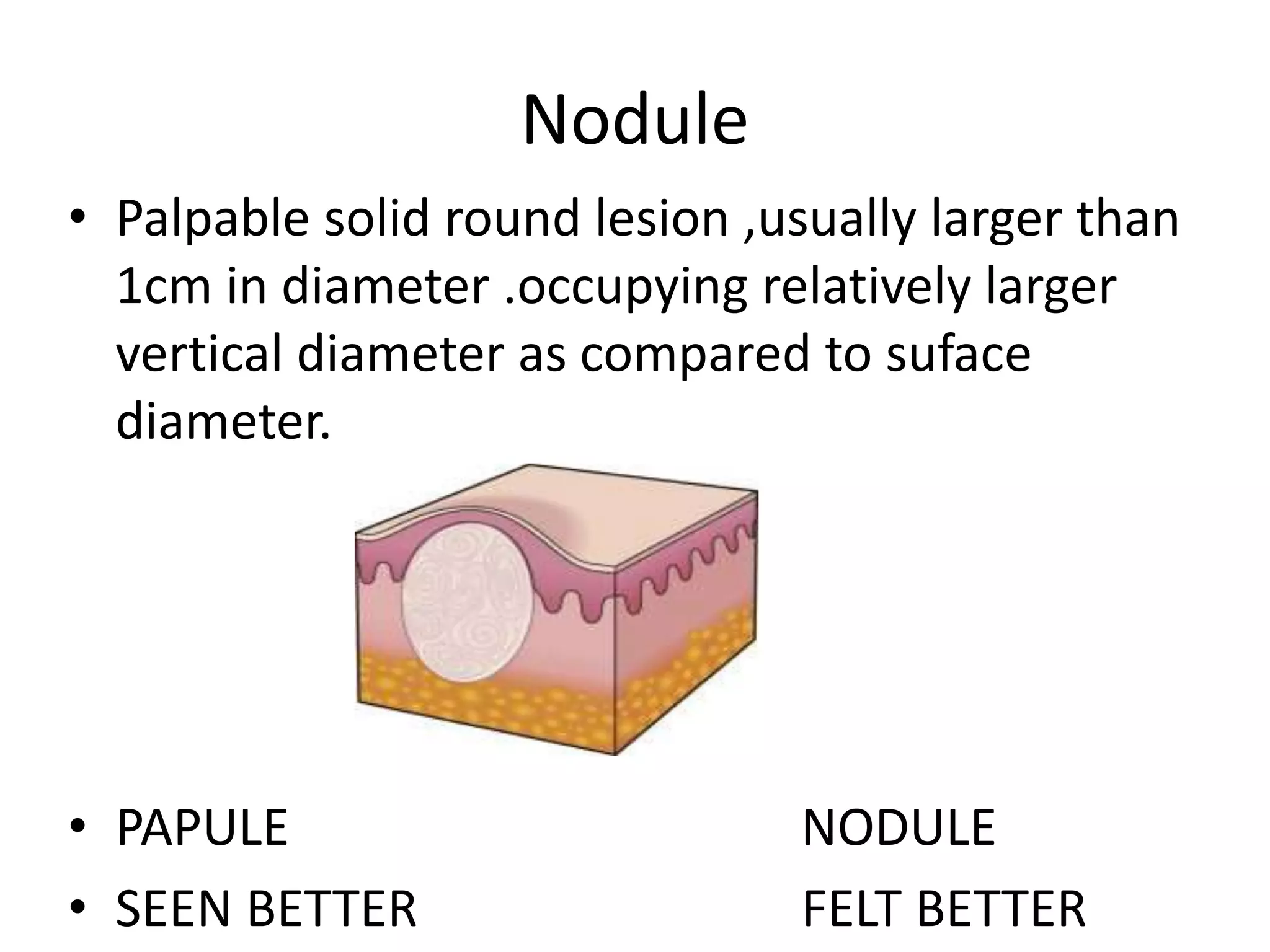 Lesions of skin | PPTX