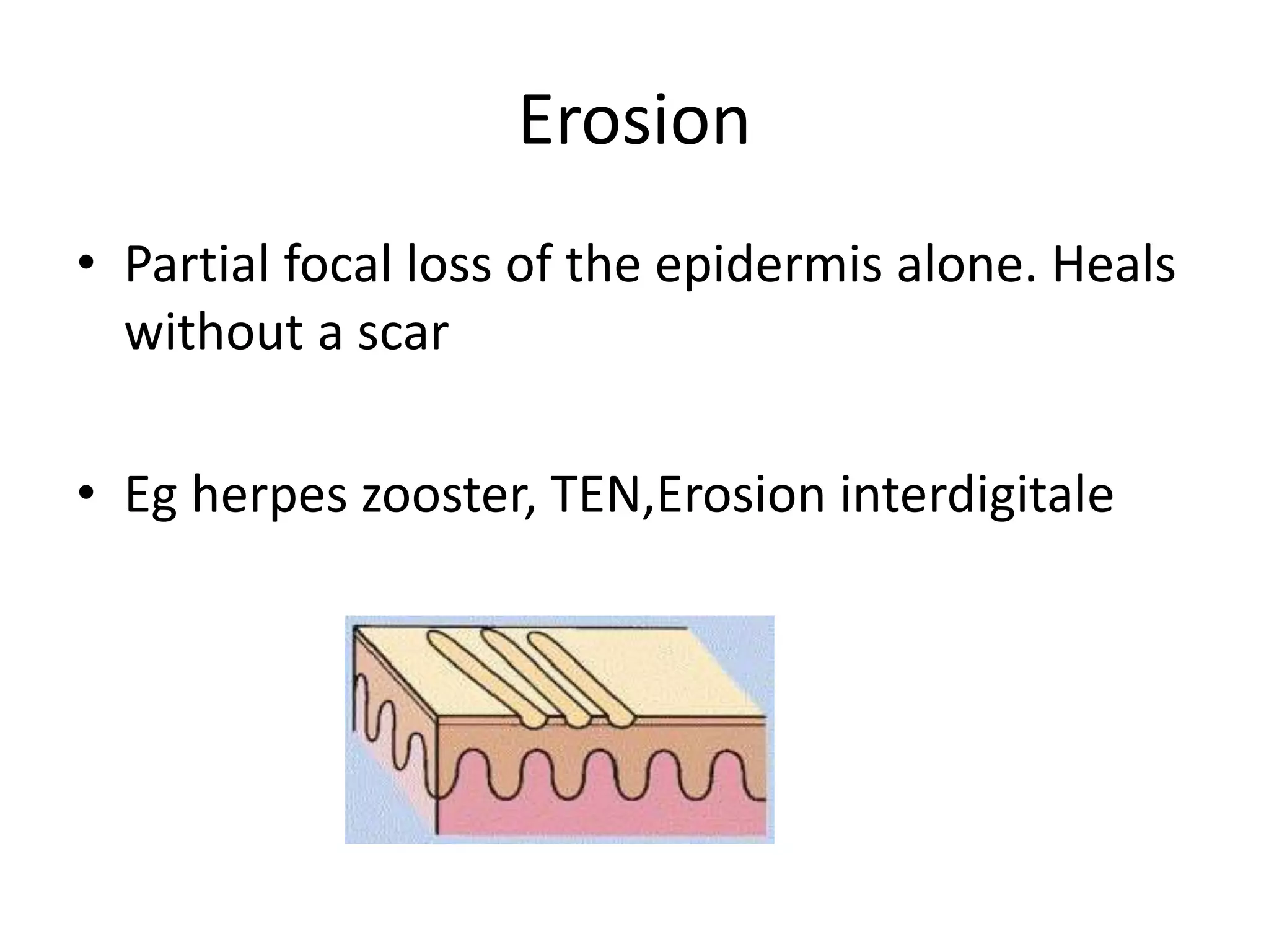 Lesions of skin | PPTX