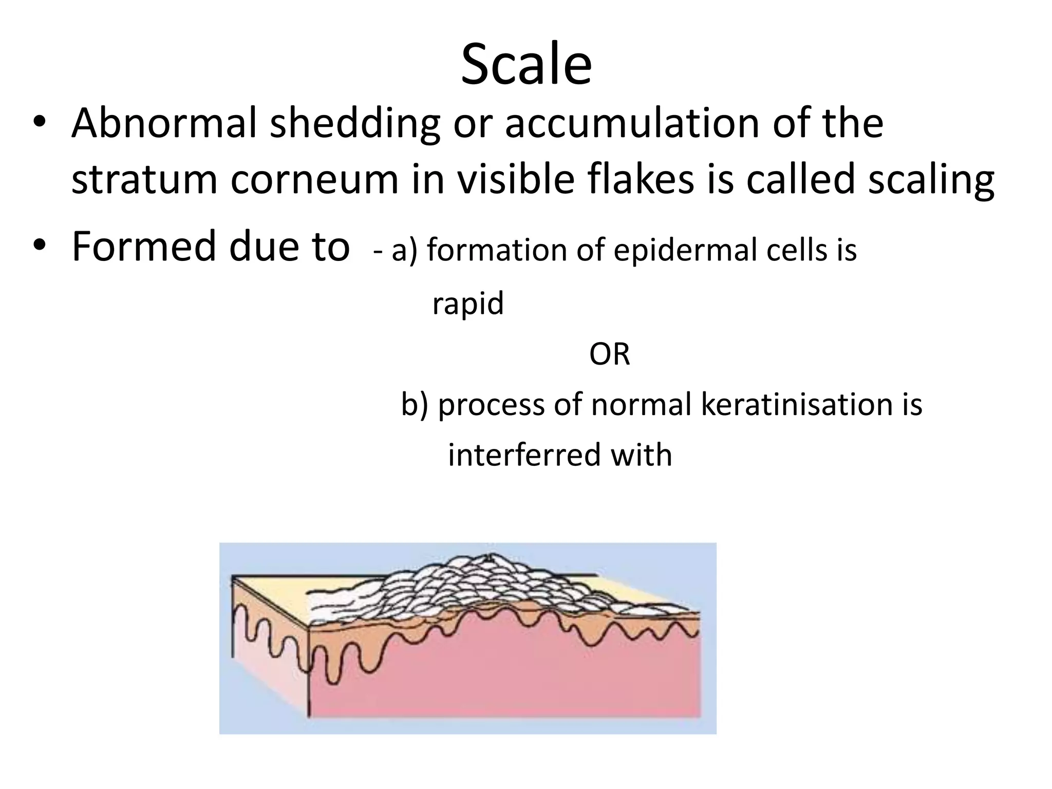 Lesions of skin | PPTX