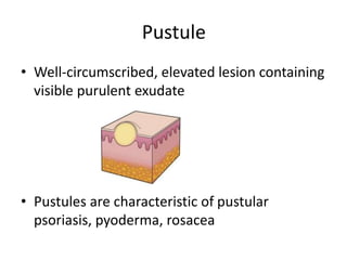 Lesions of skin | PPTX