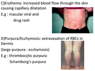 Lesions of skin | PPTX