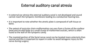 Lesions of the temporal bone & petrous ppt | PPTX