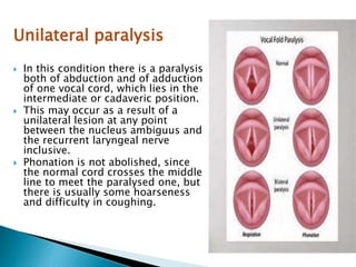 LESIONS OF THE VAGUS NERVE.ppt..........x | PPTX