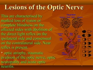 Lesions of the visual pathway | PPT