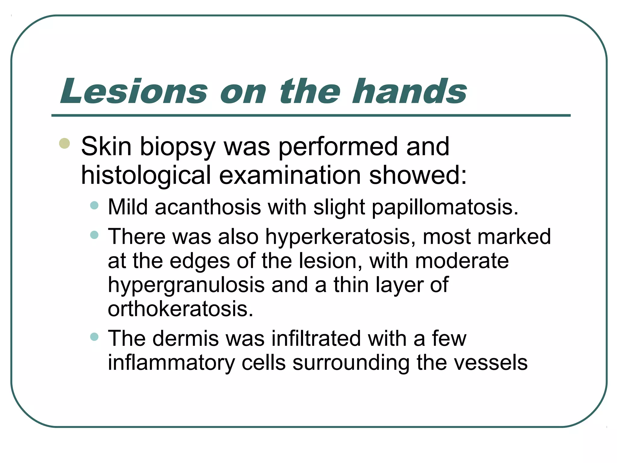 Lesions on the hands | PPT