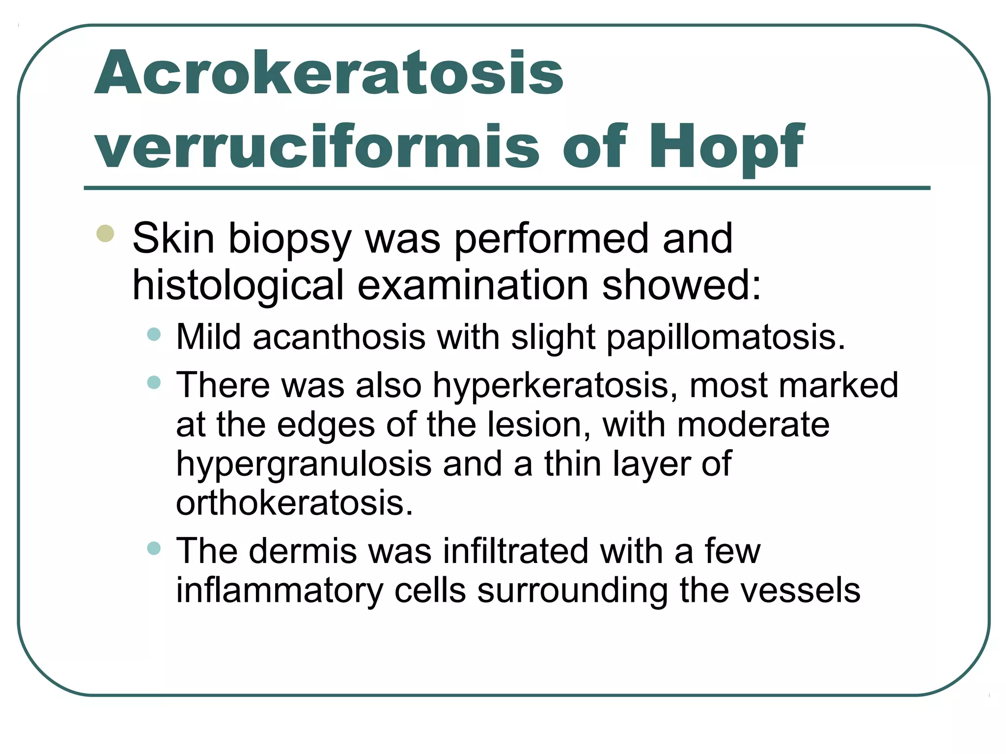 Acrokeratosis verruciformis | PPT