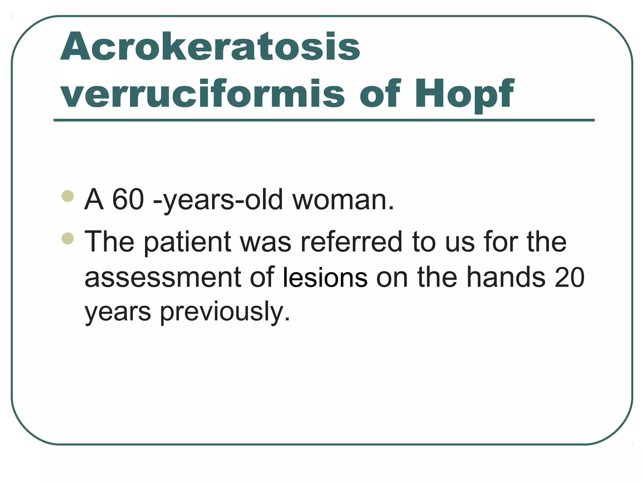Acrokeratosis verruciformis | PPT