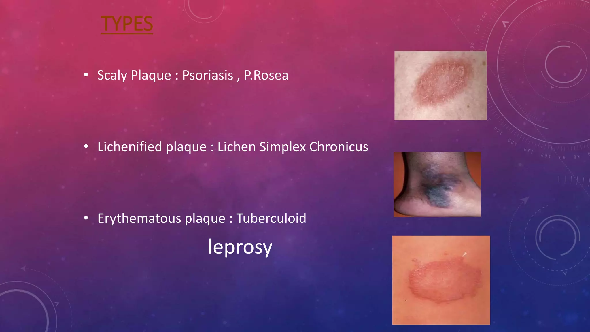 Lesion of skin | PPTX