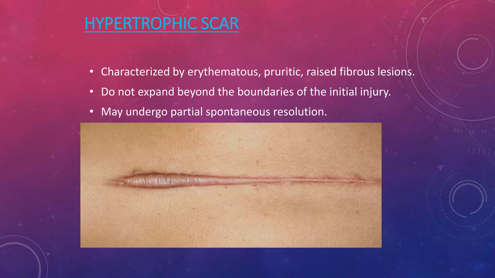 Lesion of skin | PPTX