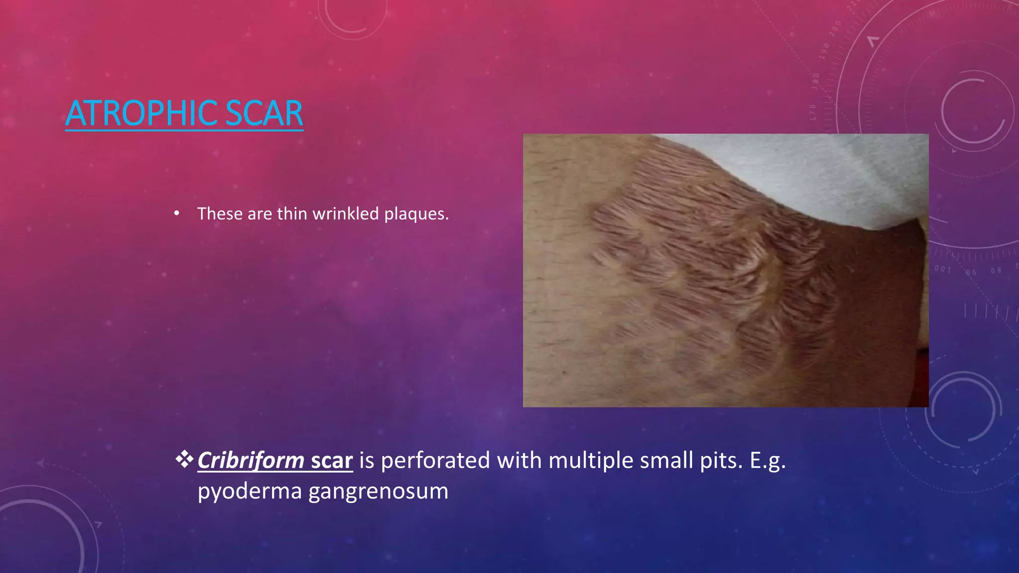 Lesion of skin | PPTX