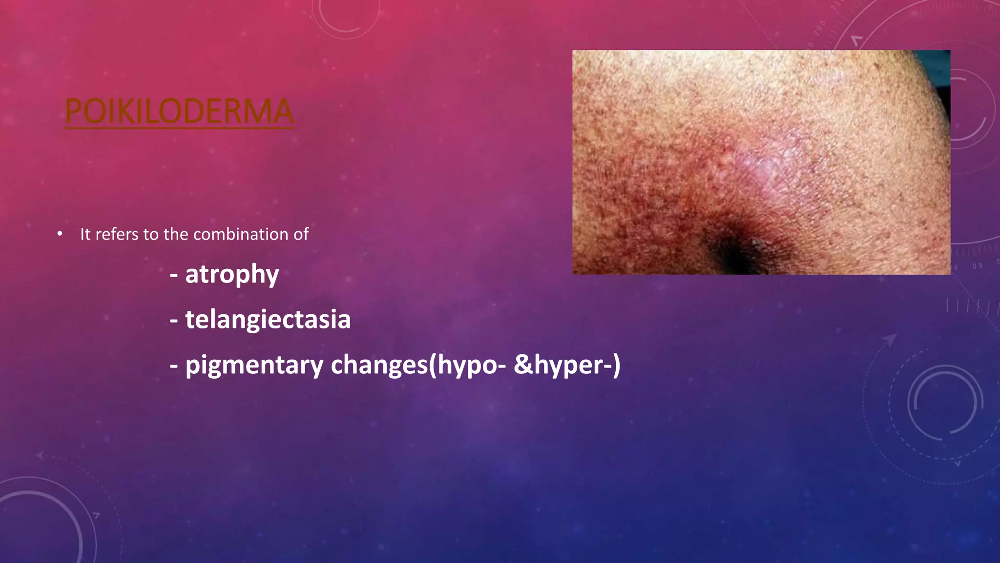Lesion of skin | PPTX