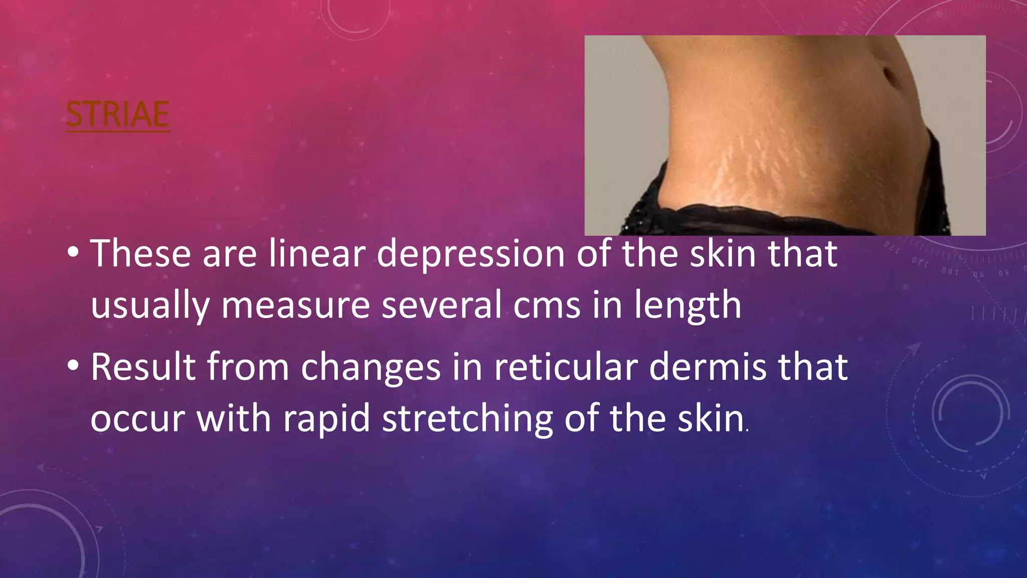 Lesion of skin | PPTX