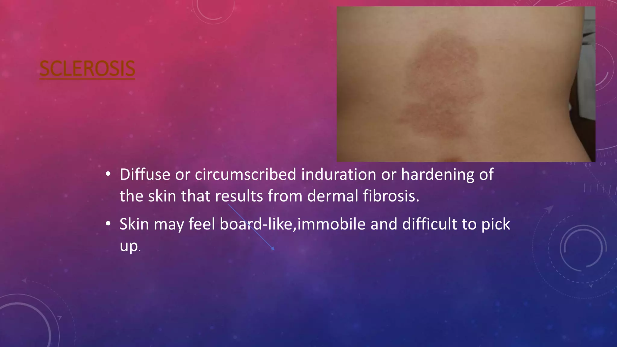 Lesion of skin | PPTX