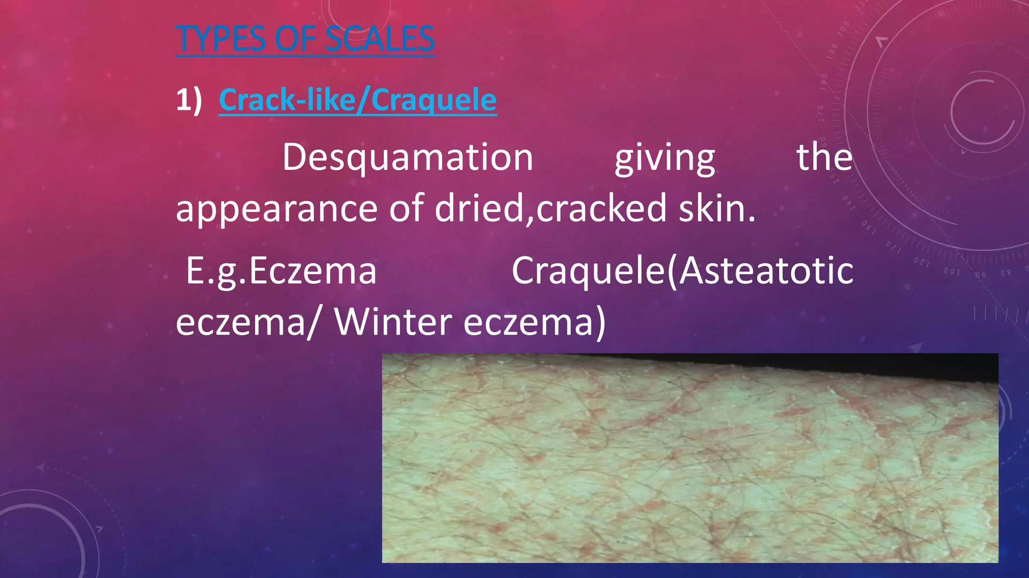 Lesion of skin | PPTX