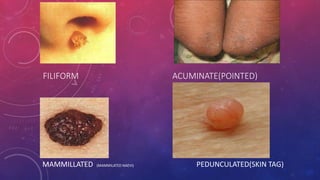 Lesion of skin | PPTX