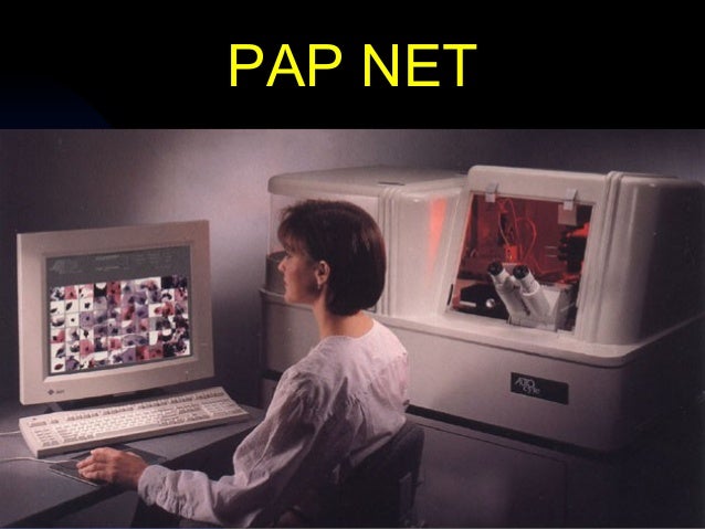 Lesi Prakanker - Dr. dr. Poedjo Hartono, SpOG(K)