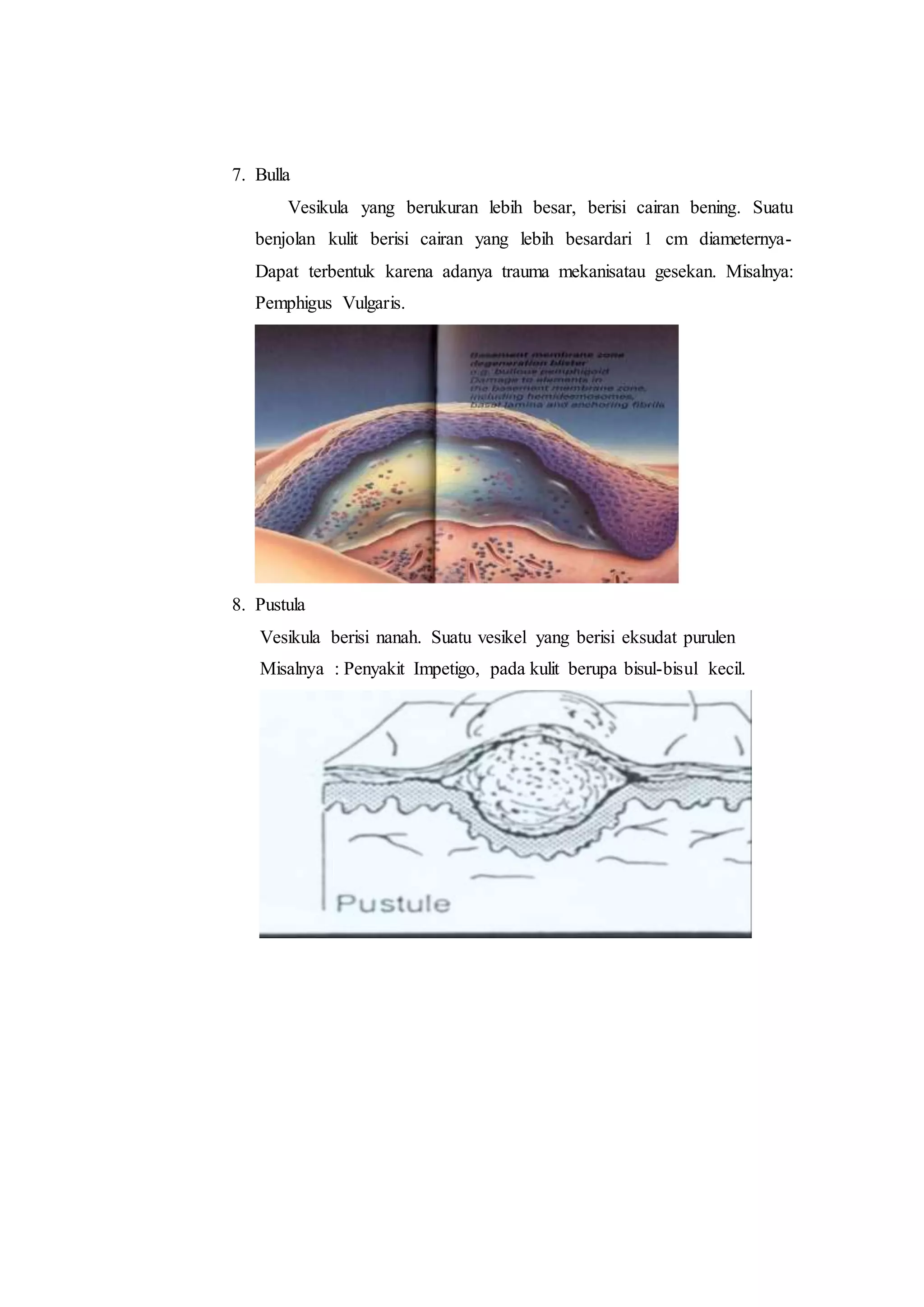 Lesi rongga mulut | DOCX