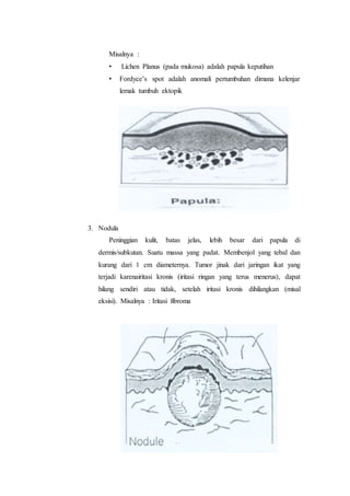 Lesi rongga mulut | DOCX
