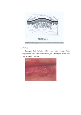 Lesi rongga mulut | DOCX
