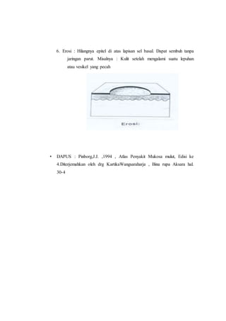 Lesi rongga mulut | DOCX