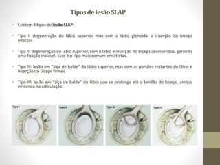 Lesão labral do tipo slap | PPTX