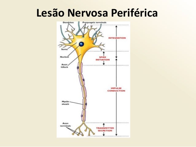 Lesão nervosa periferica