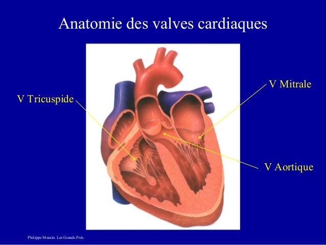 maladies et chirurgie des valves cardiaques - meurin