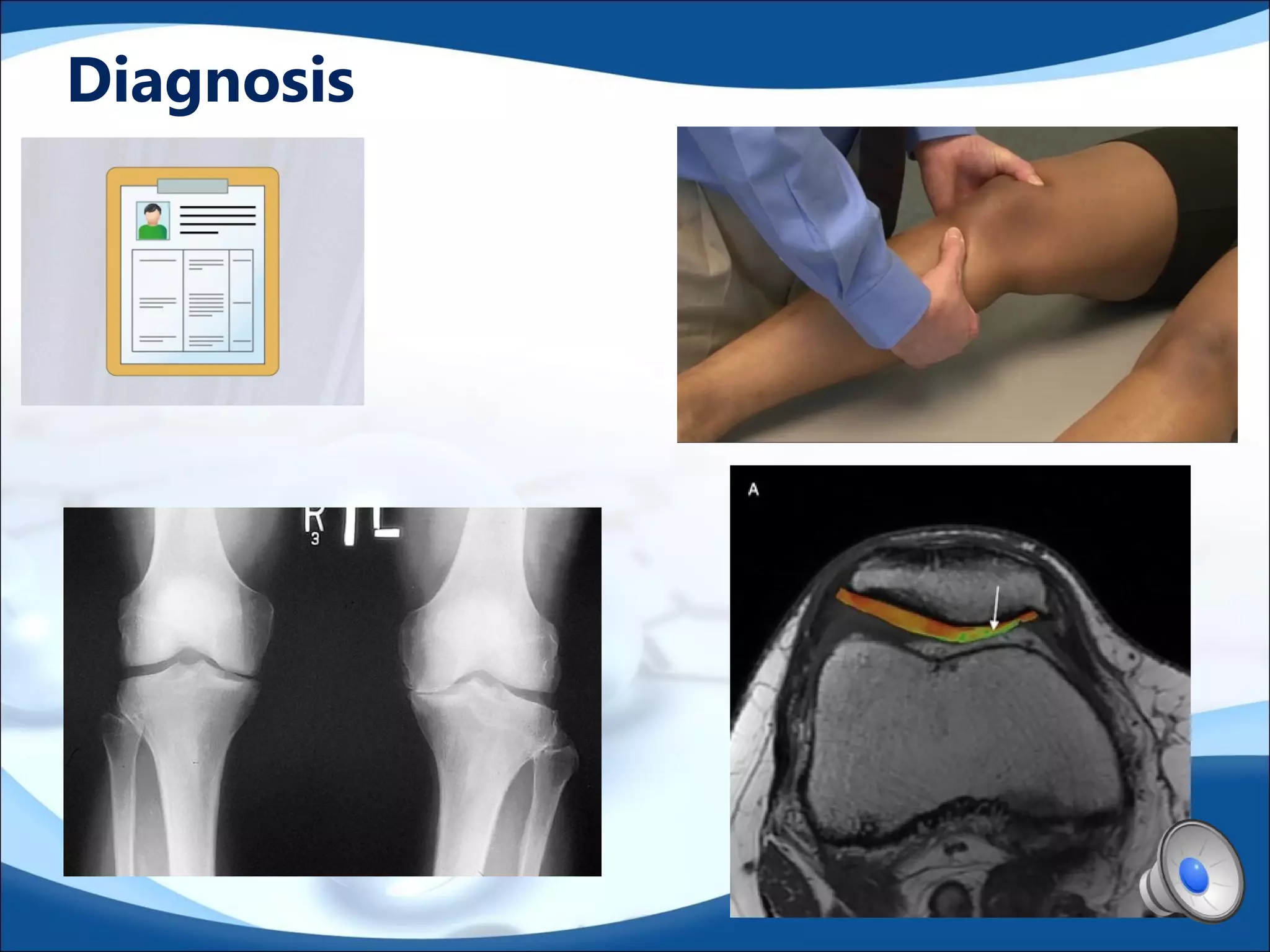 LESS current treatment of cartilage defects | PPT