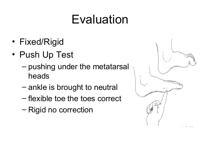 Lesser toe disorders - Derek Park