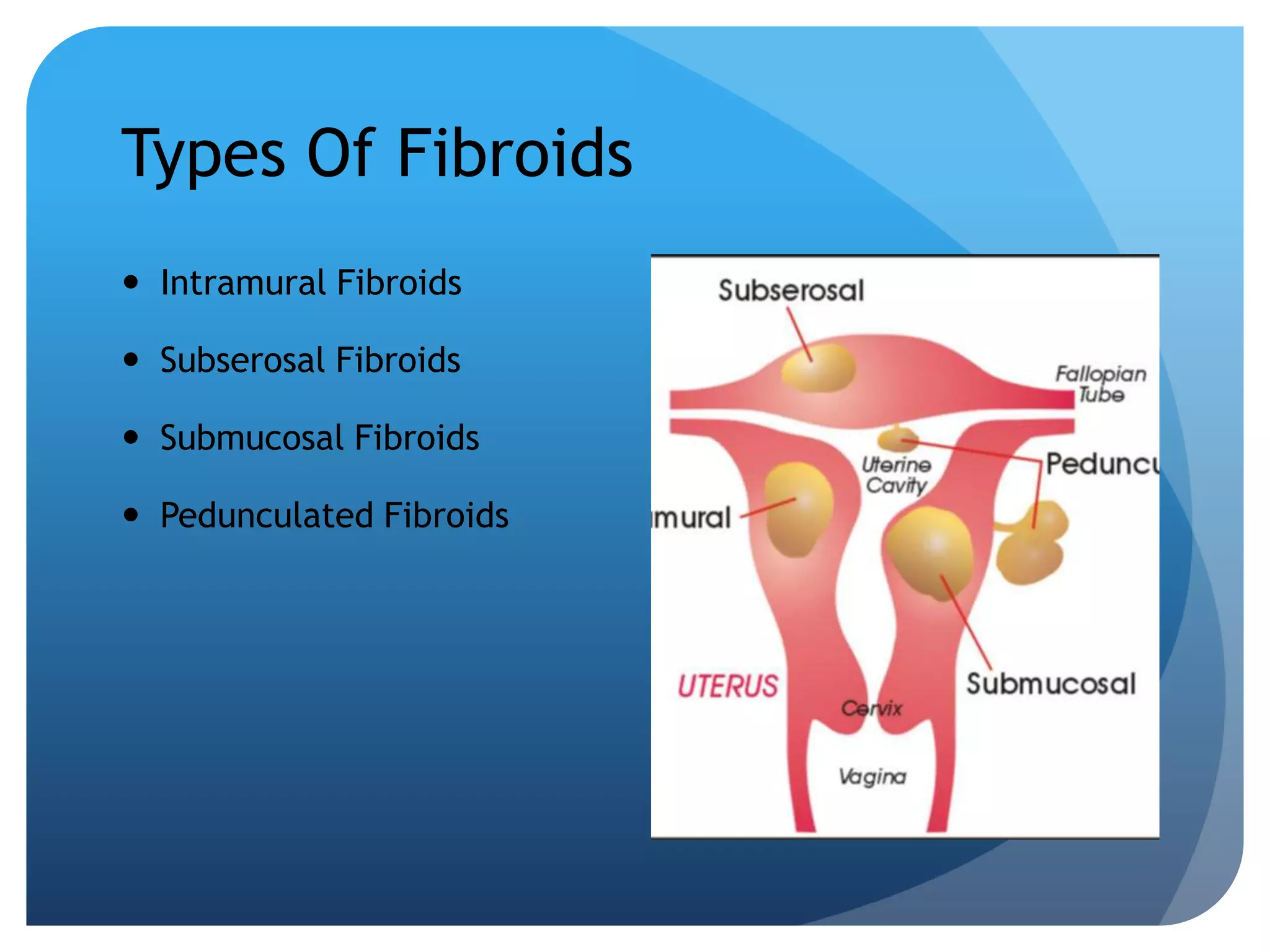 “Understanding Uterine Fibriods &Their Sonographic Appearances” | PPTX