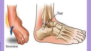 MAPEH PHYSICAL EDUCATION LESSON 2 FIRST AID | PPTX