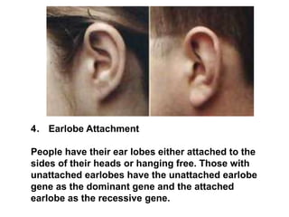Unattached Earlobes Dominant Or Recessive