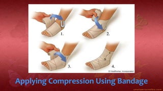 First Aid of Common Emergencies in Outdoor Activities | PPTX