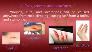 First Aid of Common Emergencies in Outdoor Activities | PPTX