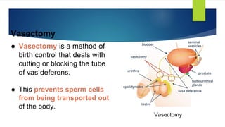lesson 1.1 grade10 male reproductive 3rd quarter..pptx