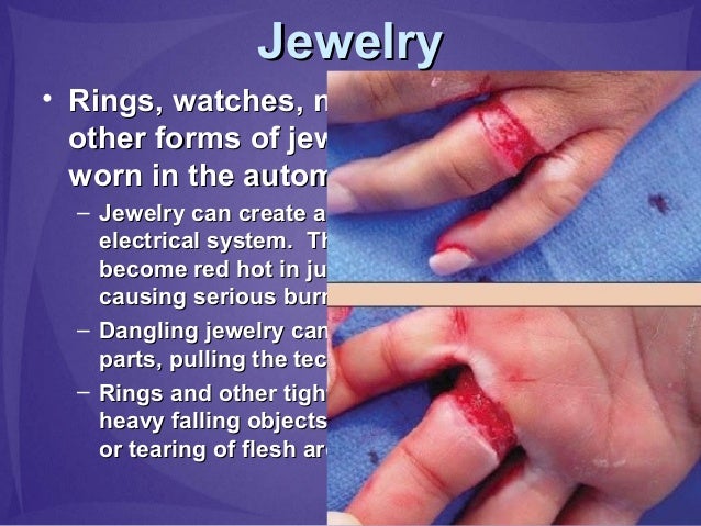 Lesson 1 general safety