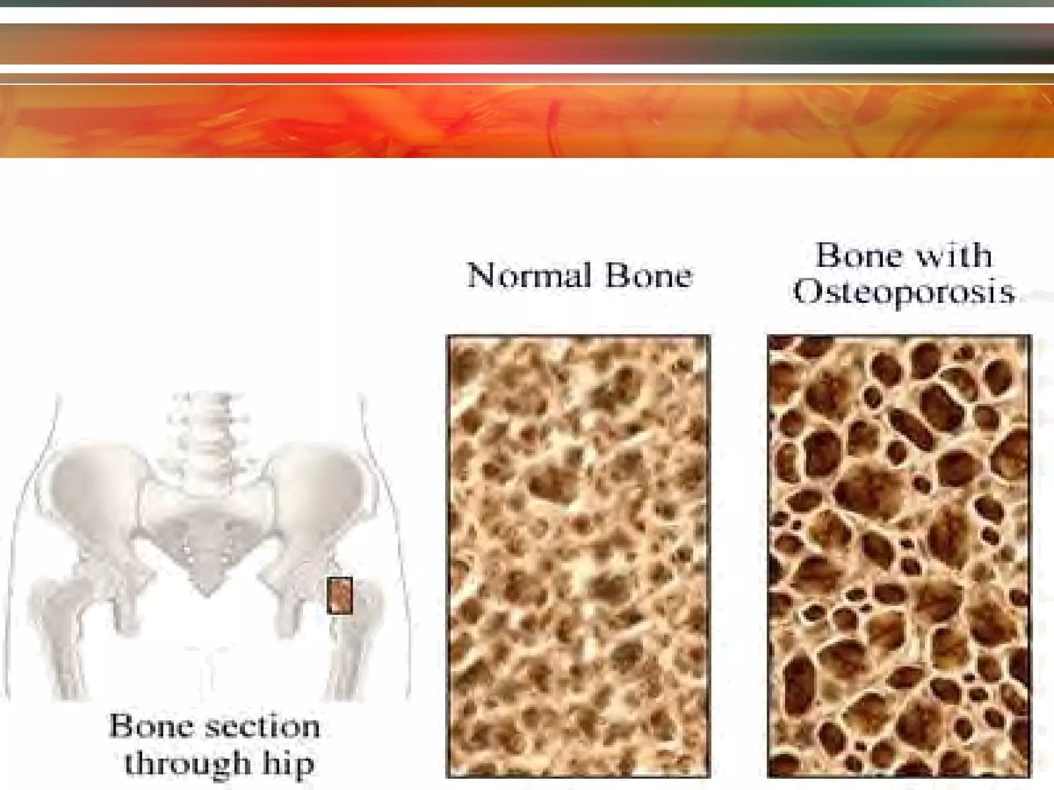Lesson 1 skeletal system | PPT