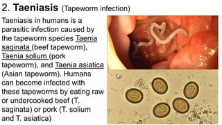 Parasitic Disease | PDF