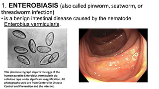 Parasitic Disease | PDF | Digestive Disorders | Diseases and Conditions