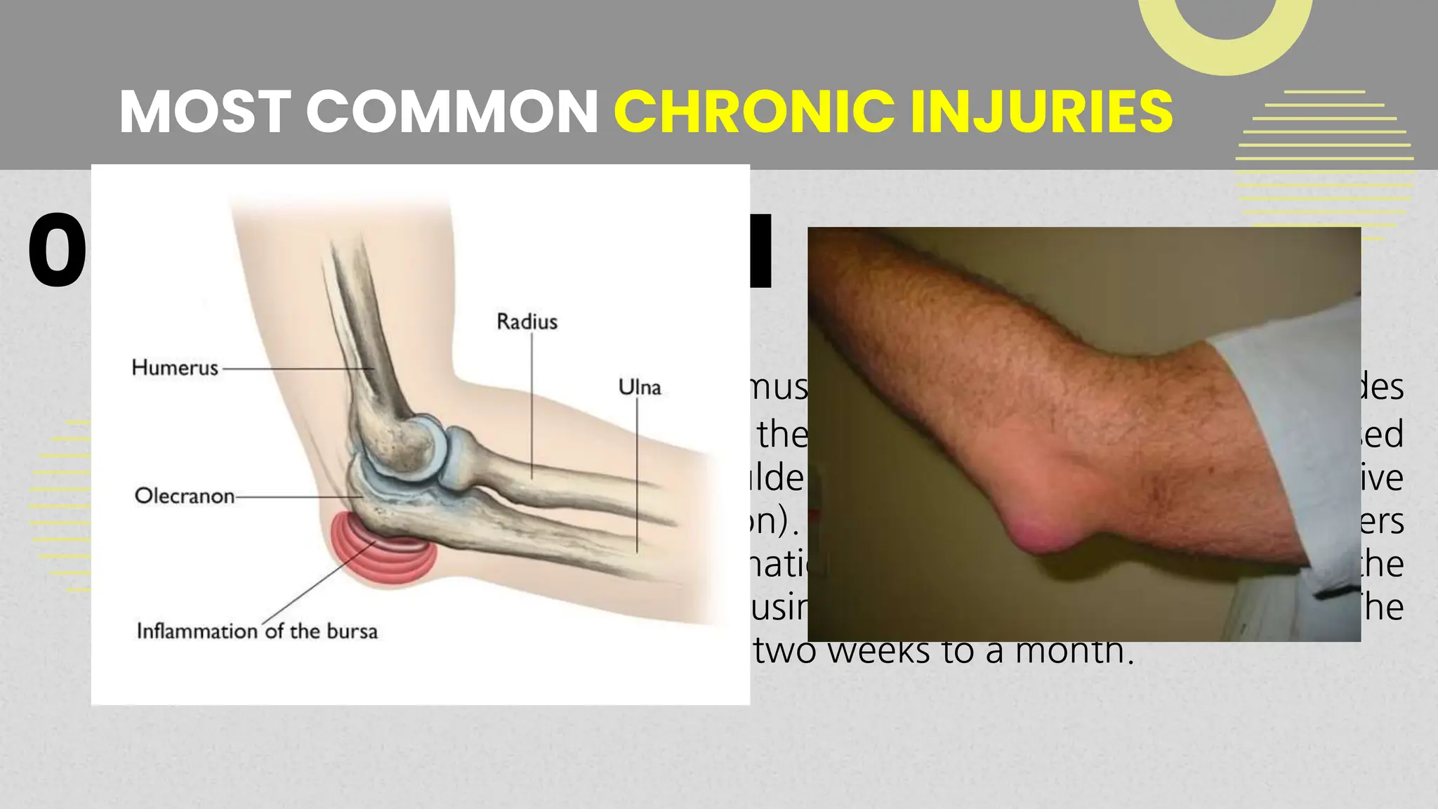LESSON 11 SPORTS INJURIESaaaaaaaaaa.pptx