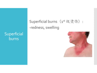 初级组 Lesson 12 | PPT