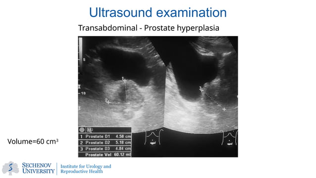 lesson 1 Imaging in urology DB.pptx urology | PPT