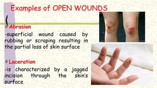 Lesson 1 learning basic first aid | PPTX
