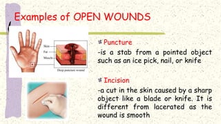 Lesson 1 learning basic first aid | PPTX
