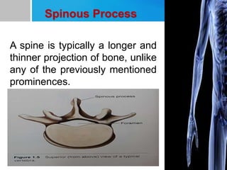 Lesson 3 (Bones).pptx