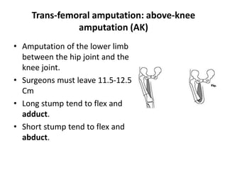 Lesson 3 Levels of Amputation.ppt