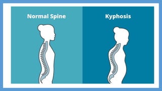 Lesson 3 taking extra care of your body | PPT | Free Download