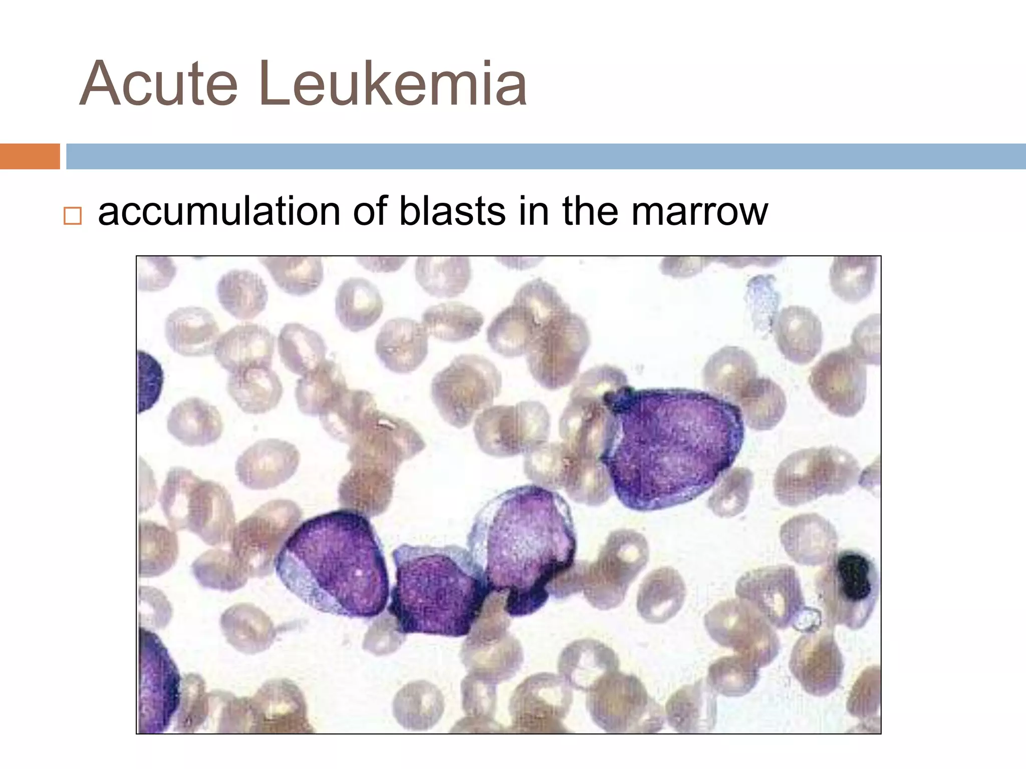 LESSON 4 leukaemia.ppt