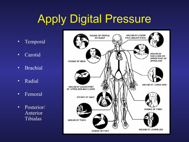 TCCC - Lesson 5 controlling bleeding.ppt