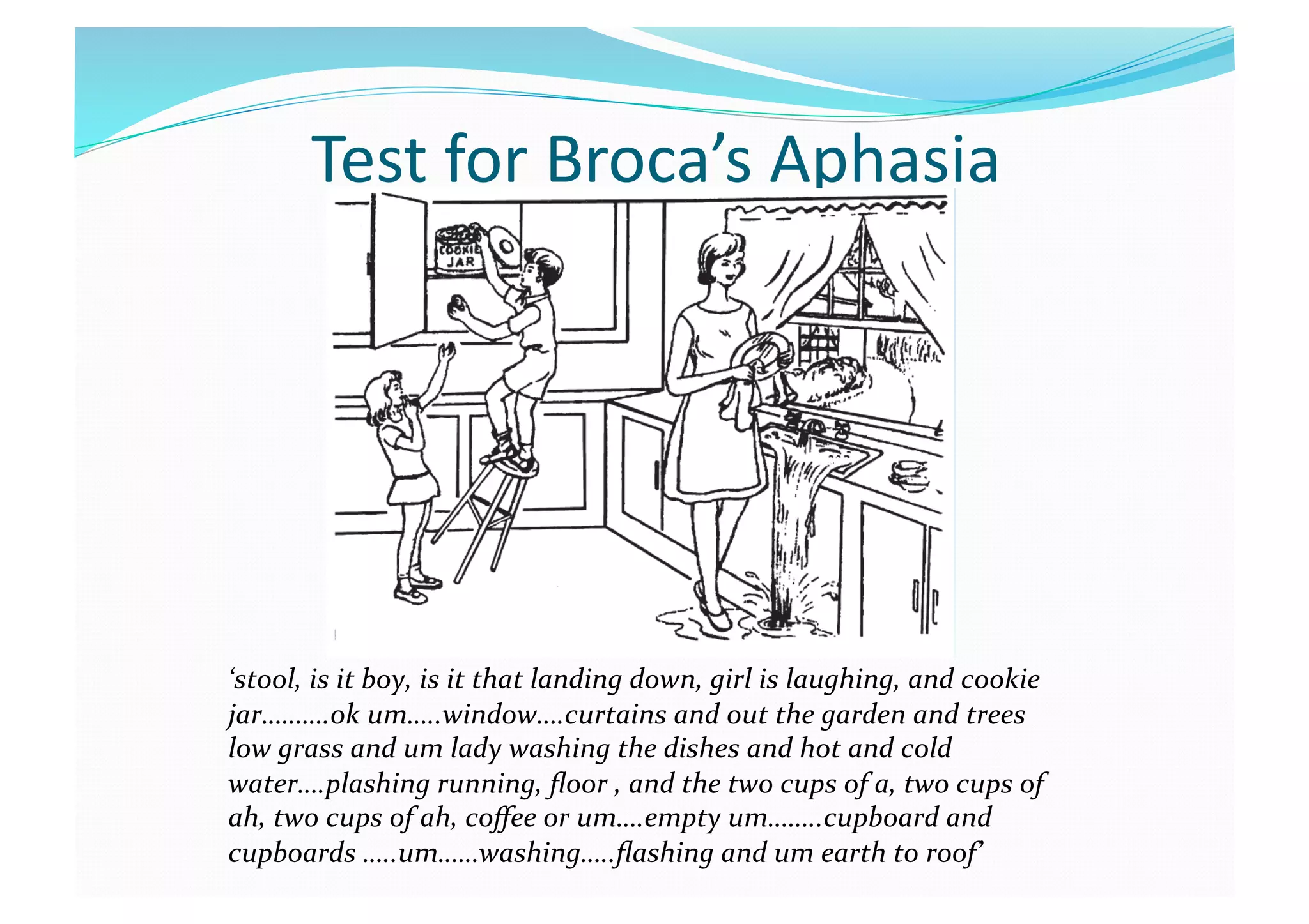 Lesson 7 broca's aphasia and wernicke's aphasia | PDF